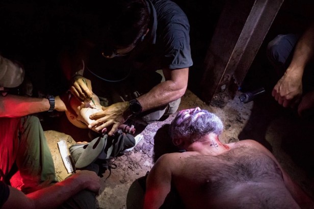 Cricothyroidotomy Training Guide for Military Medics: Ragged Edge of ...